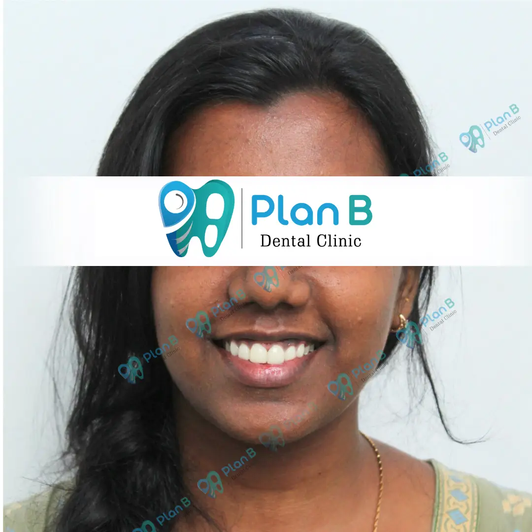 Plan B Dental Clinic